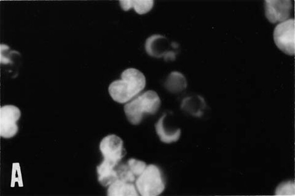 Anti-DNA Antibody, single stranded specific, clone F7-26 | MAB3299